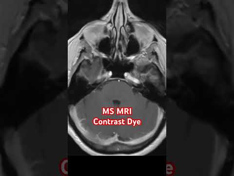 Unlocking Brain Insights with Advanced Contrast MRI