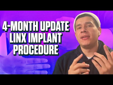Revolutionizing Health: Embrace the Linx Procedure Today
